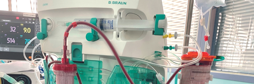 ECCO2R: Efektivní miniinvazivní metoda k podpoře plicních funkcí ...